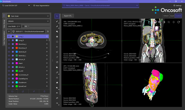 Qt 그룹, 온코소프트와 협업···AI 의료 영상 처리 기술 고도화